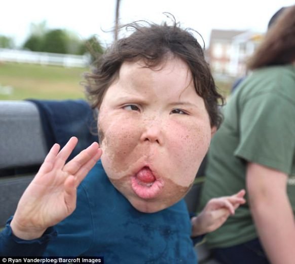 7 Of The Rarest Medical Conditions You Will Ever See - Booboone.com